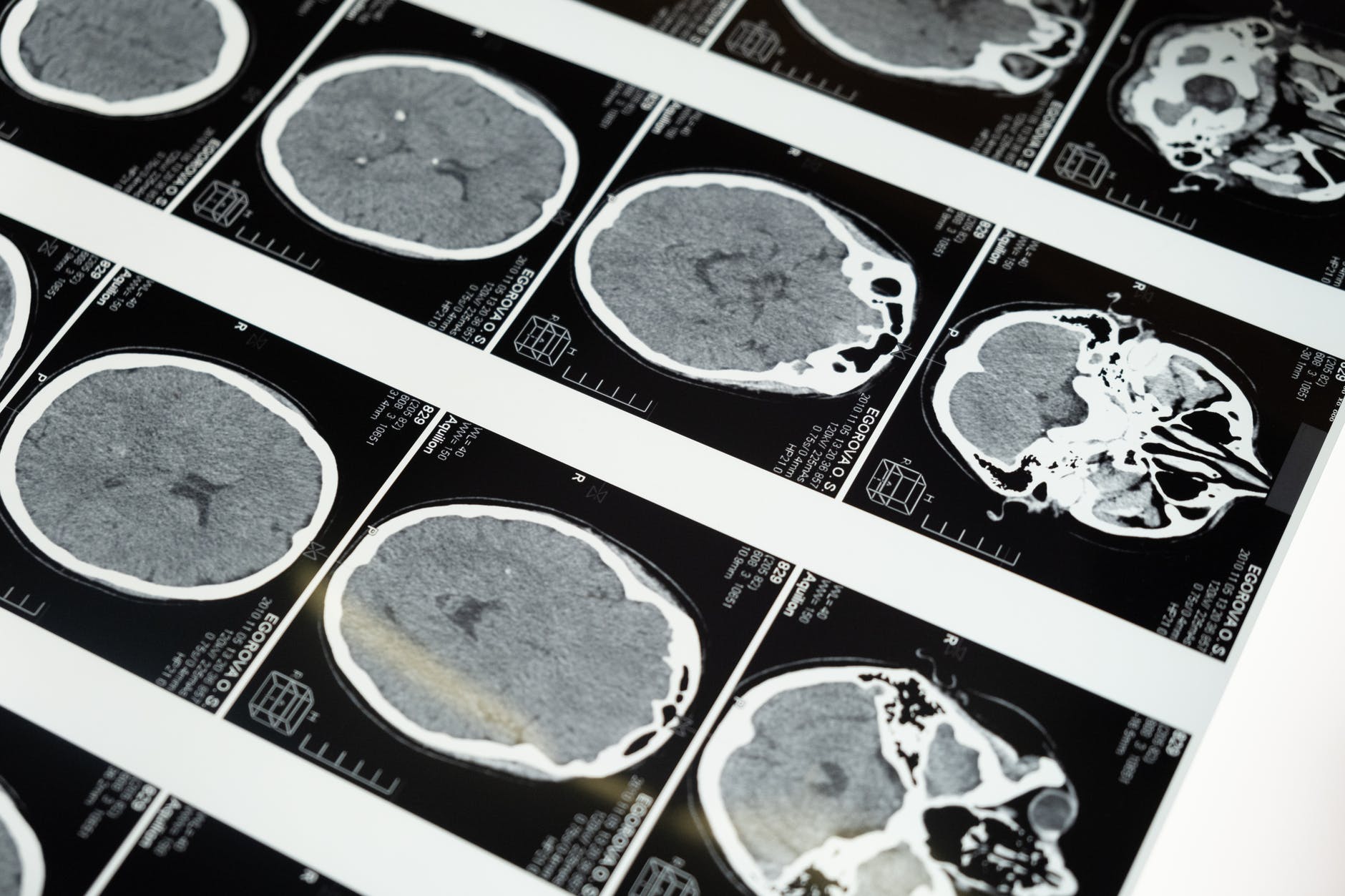 Staff – UBMD Neurology: Division of Neuropsychology